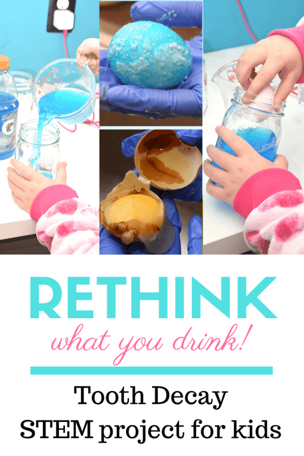 Teaching Kids about Tooth Decay | The TipToe Fairy